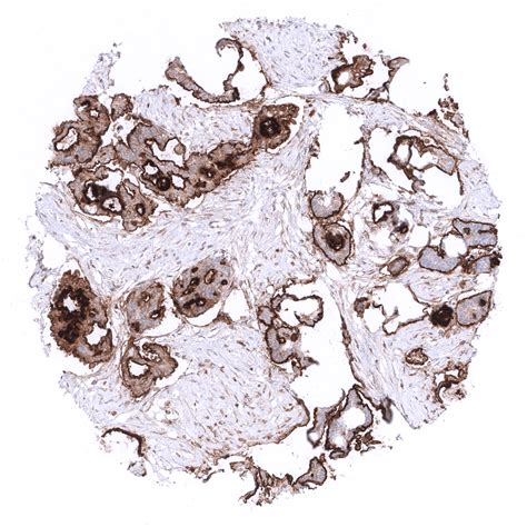 Cancer Tissue Gallery Mesothelin Ms Validated Antibodies