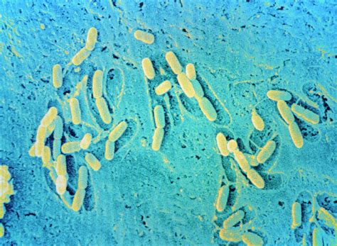 Col Sem Of Bacteria On Toothbrush Filament Photograph By Power And