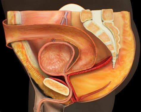 High Pressure Distal Colostogram In Recto Bladder Neck Fistula