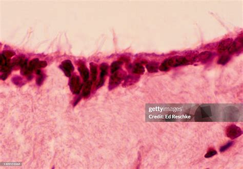 Ependyma Ciliated Cells Lining The Central Canal Of The Spinal Cord
