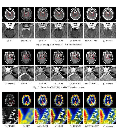Figure 8 Coupled Feature Learning For Multimodal Medical