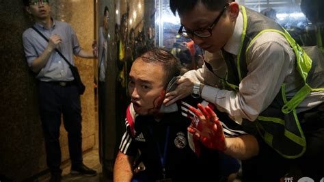 【逃犯條例】涉咬甩趙家賢耳朵案 控方指3名證人認出被告