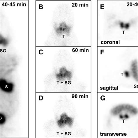 Pdf Distribution And Dynamics Of Tc 99m Pertechnetate Uptake In The