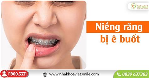 Niềng răng bị ê buốt