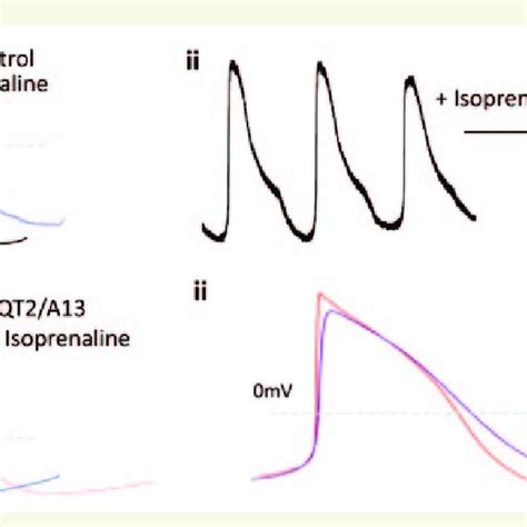 Long Qt Syndrome Type 2 Hipsc Cardiomyocytes Can Recapitulate The Download Scientific Diagram