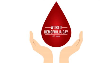 World Hemophilia Day 2023 Symptoms Causes Diagnosis And 59 Off