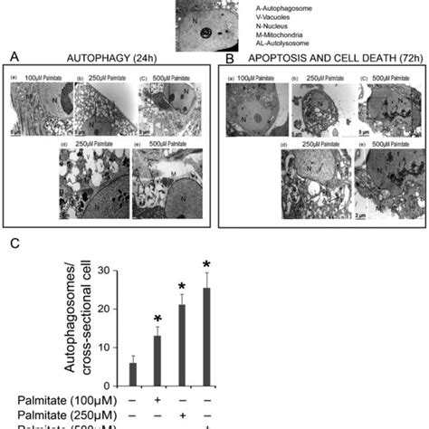 A Transmission Electron Micrograph Of Ob Showing Autophagic Vacuoles