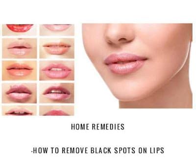 Black Spots On Lips Causes Lipstutorial Org