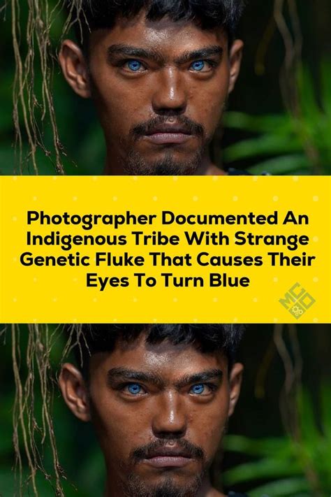 Photographer Documented An Indigenous Tribe With Strange Genetic Fluke