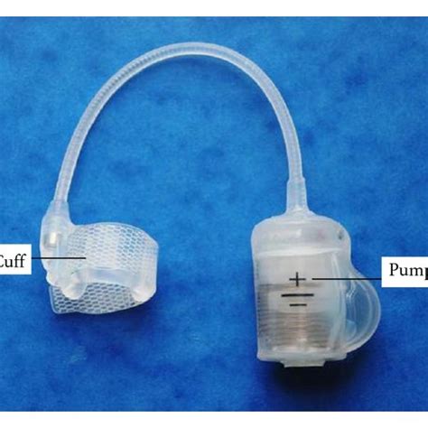 Pdf New Artificial Urinary Sphincter Devices In The Treatment Of Male