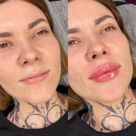 Меня зовут Светлана я врач косметолог Требуются модели на мастер класс и личный приём в