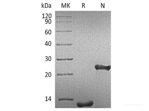 Quality Reliable Recombinant Human Tgfb1tgf Beta 1 Protein Active
