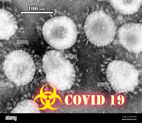 Coronavirus Covid 19 Severe Acute Respiratory Syndrome Coronavirus 2