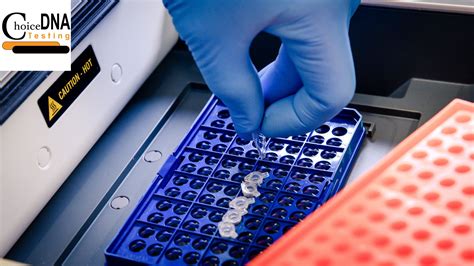 Non Invasive Prenatal Paternity DNA Test And Its Detailed Analysis