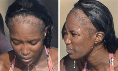 Naomi Campbell S Shocking Bald Patches After Years Of Relying On Hair