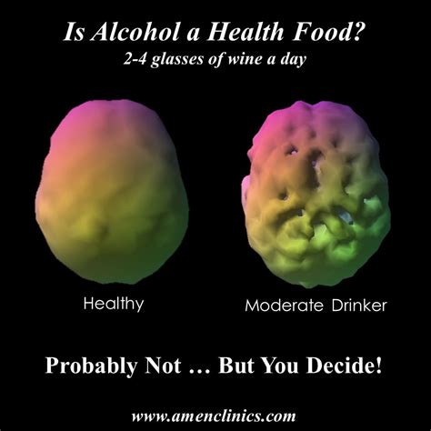 Alcohol And Depression Brain Scan
