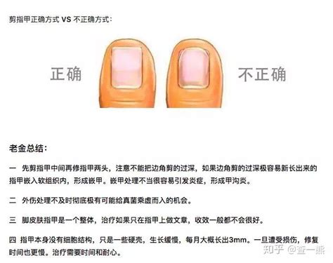 科普今天你嵌甲了吗 知乎