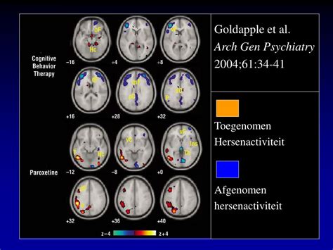 Ppt Psychotherapie Bij Persoonlijkheidsstoornissen Bewezen Effectief
