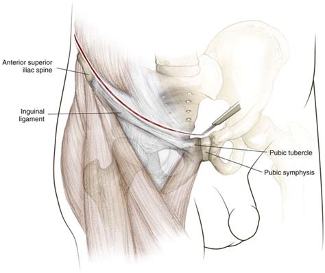 Hip And Pelvis Musculoskeletal Key