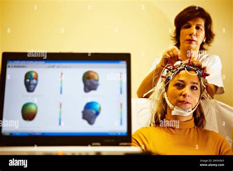 Cartography Electroencephalography Neurological Examination Hospital Policlinica Gipuzkoa