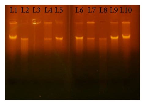Agarose Gel Electrophoresis 12 Of Genomic Dna From Nondiabetic