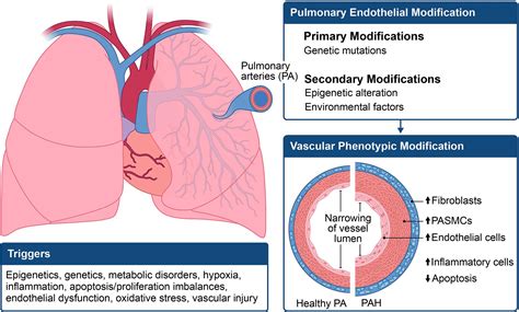 Frontiers Exploring The Pathogenesis Of Pulmonary Vascular Disease