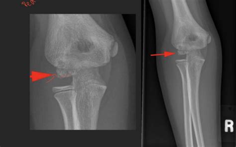 Nms Final 2023 Flashcards Quizlet