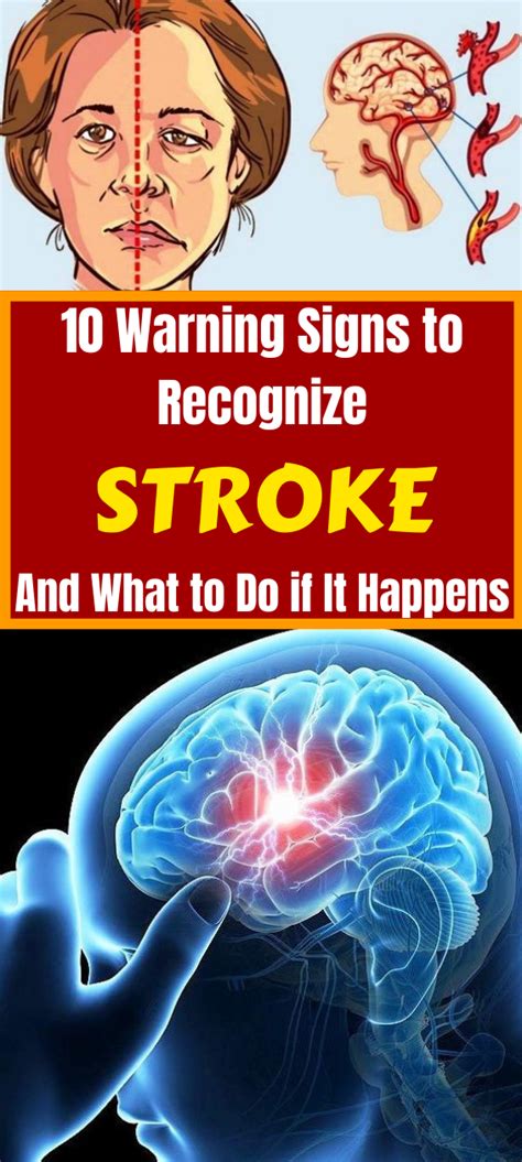 10 Warning Signs To Recognize Stroke And What To Do If It Happens Only Tips