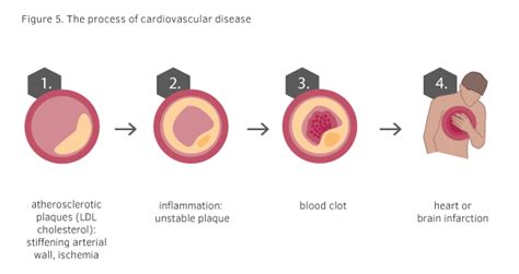 Beer And Cardiovascular Disease Beer And Health