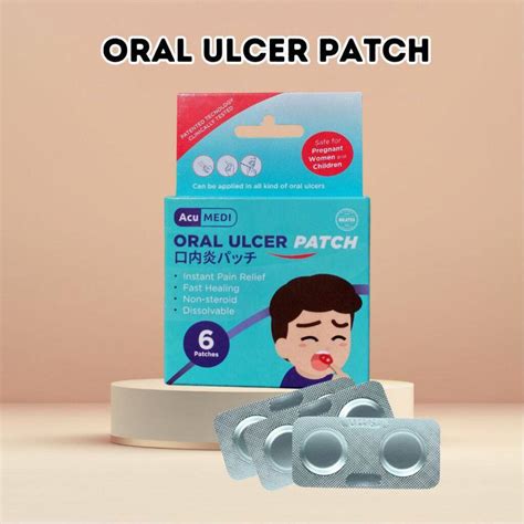 Pelekat Ulser Mulut Oral Ulcer Patch 口腔溃烂，口腔炎 贴 Lazada