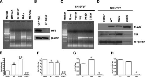 Expression Of Hfe In Human Brain Derived Cell Lines And Effect Of