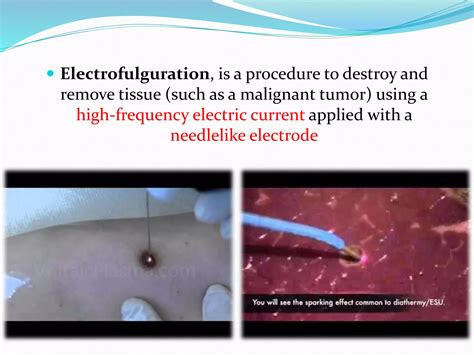 Classification Of Periodontal Instruments Pptx