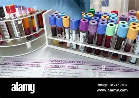 Technician Lab With Blood Testing Over Requisition Report For