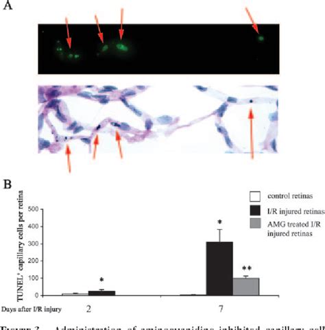 Figure 3 From Retinal Ischemia And Reperfusion Causes Capillary Figure 3 From Retinal Ischemia And Reperfusion Causes Capillary