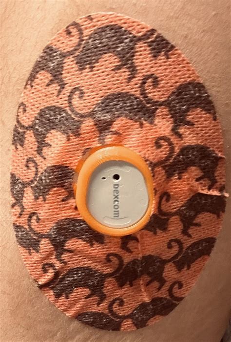 Removing Dexcom G7 Sensors Rdexcom