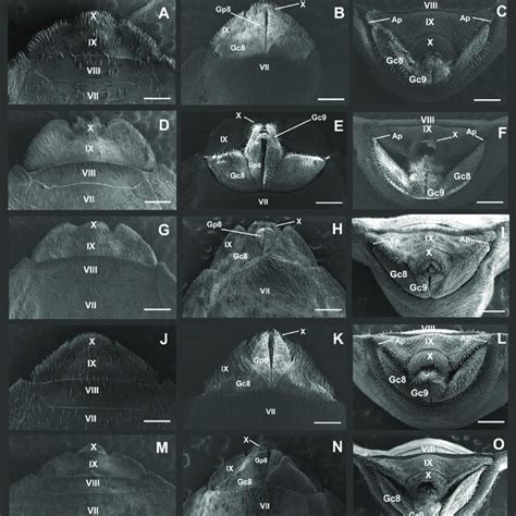 Female External Genitalia Examined By Scanning Electron Microscopy