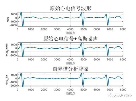 【心电信号去噪】基于奇异谱svd算法ecg信号去噪附matlab代码ecg信号怎么用sdv分解去噪 Csdn博客