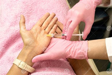 Treatment Hyperhidrosis Botulinum Toxin Stock Image Image Of Girl