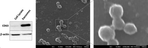 Characterization Of Exosomes Western Blots Show Enrichment Of Cd63 In