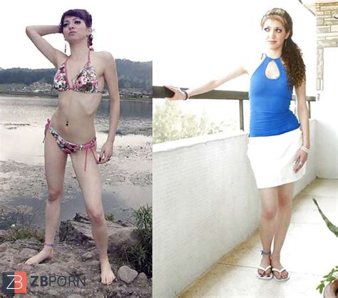 Teenagers Clothed And Unclothed Dressed Disrobed Before After Zb Porn