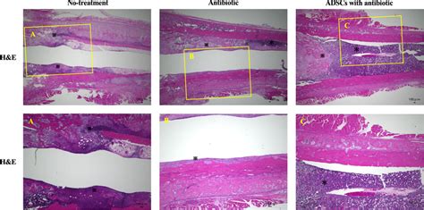 Histologic Analysis Representative Photomicrographs Of Histologic