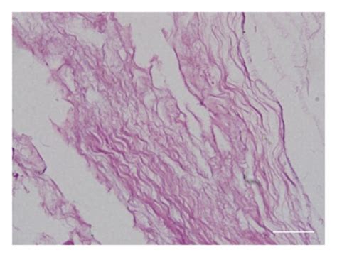 Perfusion Decellularization Of Murine Pancreas Gross Picture A