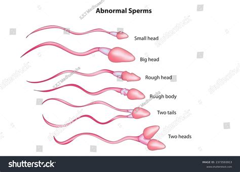 Biological Anatomy Abnormal Sperms Abnormal Sperm Stock Vector Royalty Free 2373593913