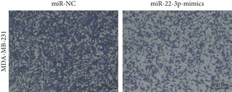 Mir 22 3p Suppressed Cell Migration Of Bc Cells Ac Wound Healing