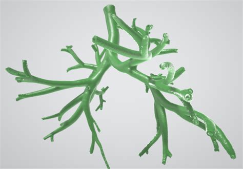 🫁 3d Lungs With Detailed Larynx Trachea Bronchi Bronchioles And