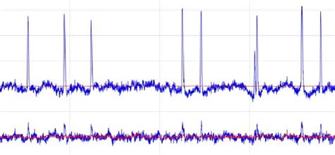 figure 1 from removal of eye blink artifacts from eeg signal semantic