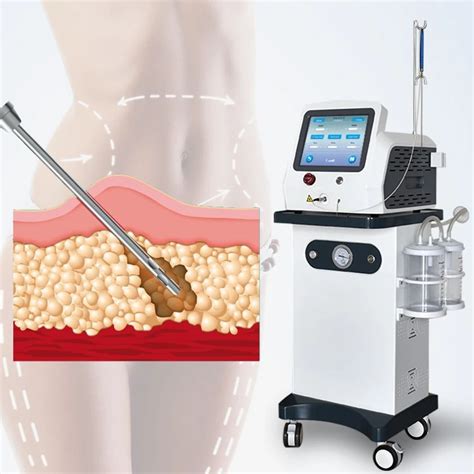30W 980nm Diode Laser Lipolysis Liposuction Machine Plastic Surgery