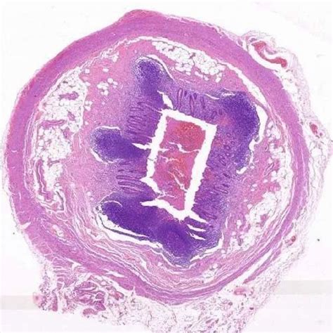 H And E Histology Slide Jejunum For Hospital For Medical Teaching