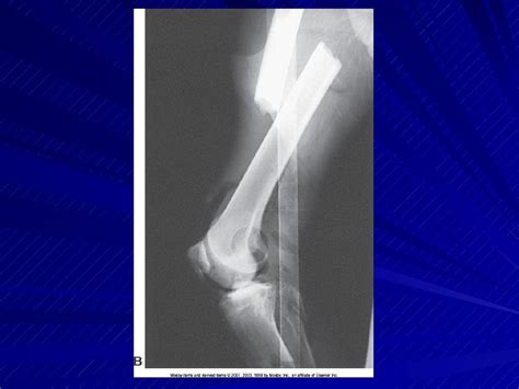Trauma Radiography