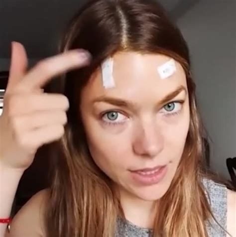 Laura Laprida Reveló Que Sufrió Cáncer De Piel